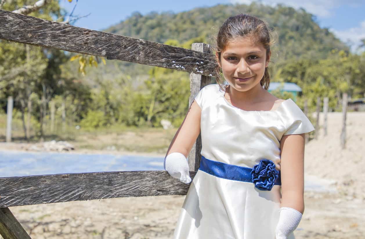 4 Things I’ve Learned From Living Without Hands - Compassion ...