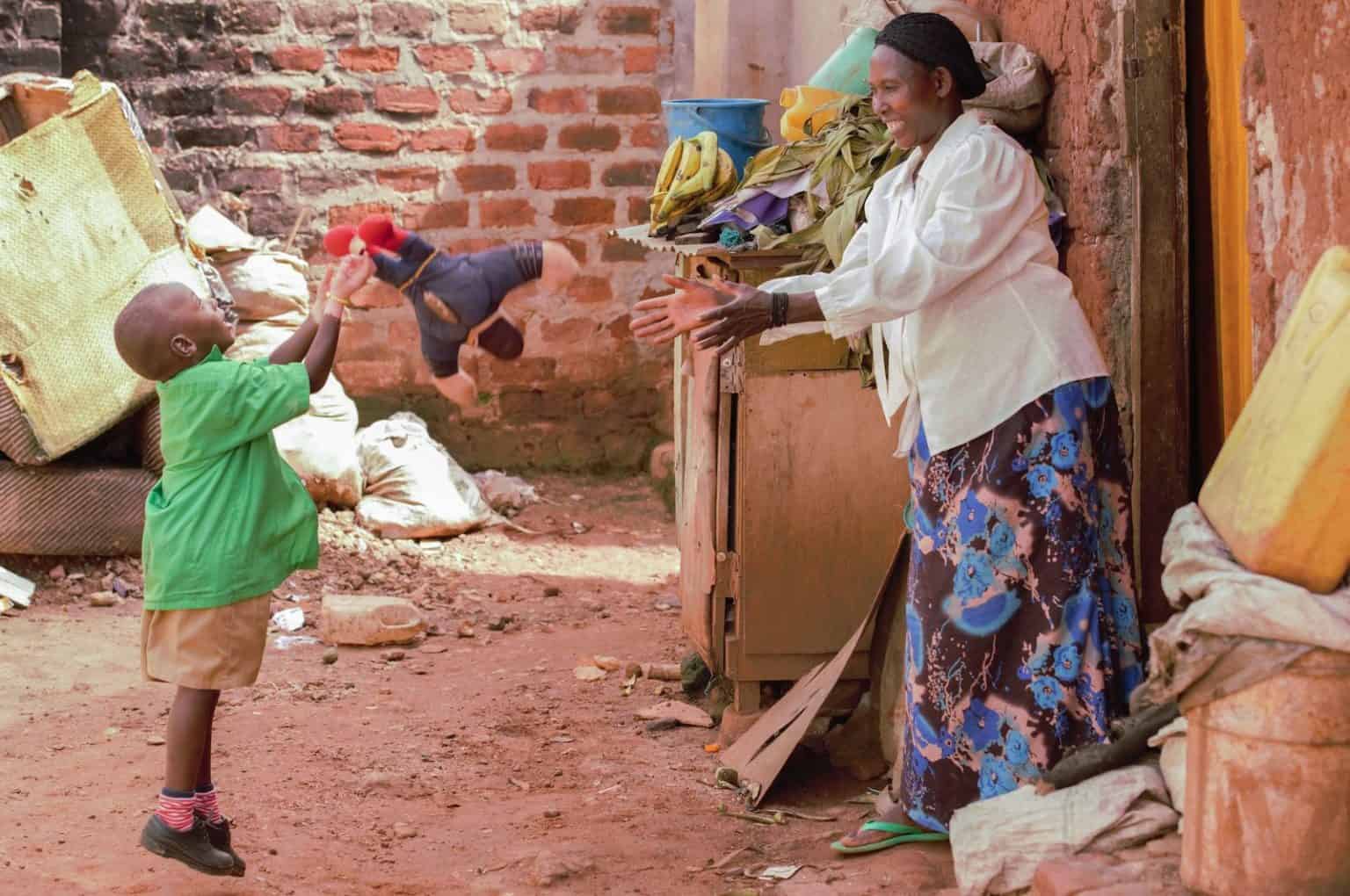 Waardenburg Syndrome: Shakul & His Striking Blue Eyes